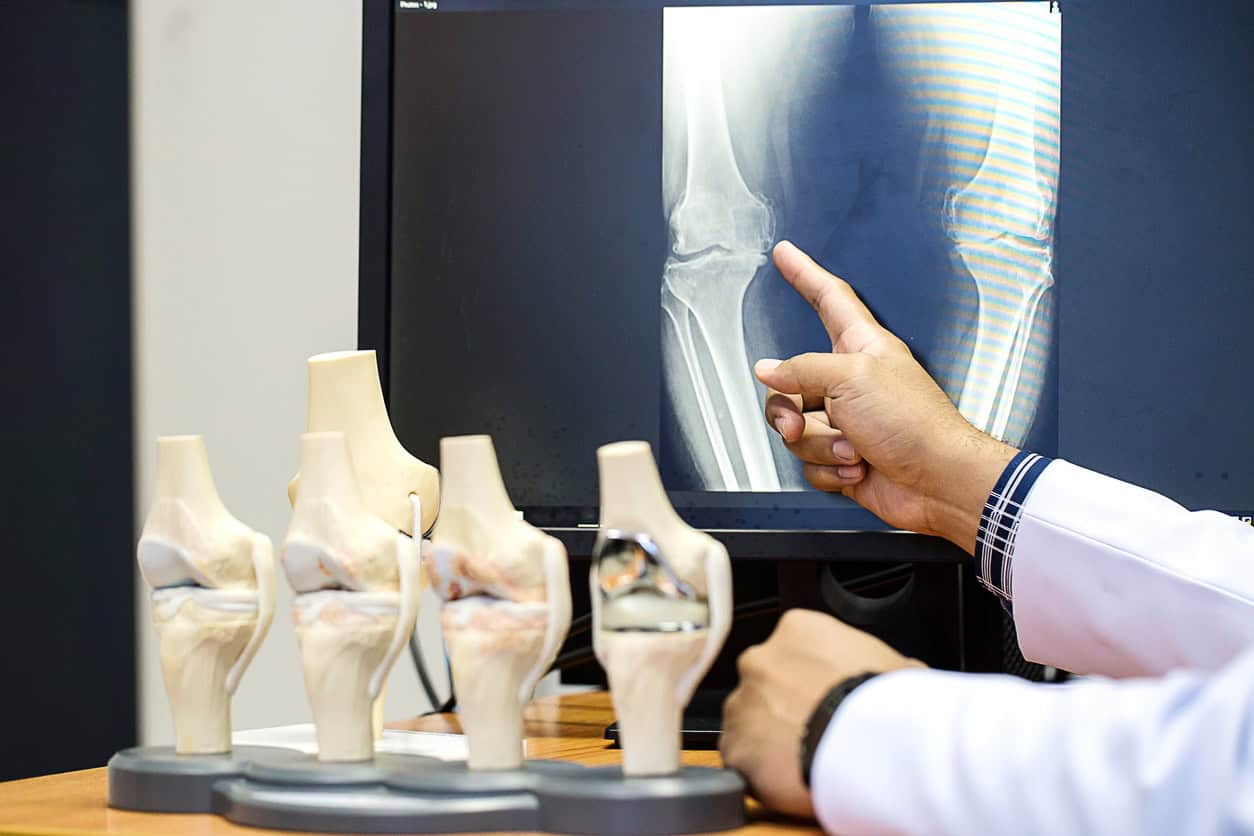 Epidural Injections or Facet Joint Injections? | The Spine Diagnostic ...