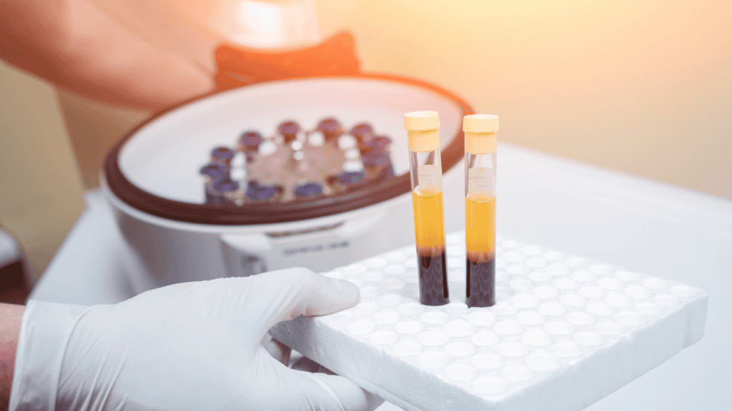What You Should Know About PRP Injection Therapy | The Spine Diagnostic ...